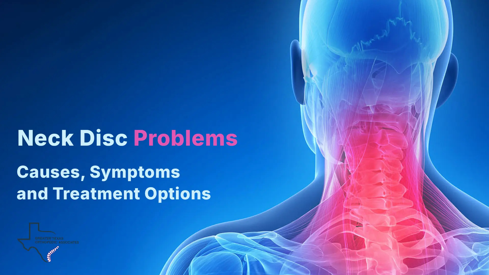 Neck Disc Problems: Symptoms, Causes & Treatments - GTOA